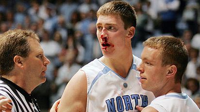 tyler hansbrough bloody nose duke